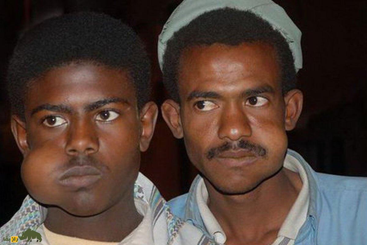 قات یا تریاک یمنی؛ «قات زدن» یعنی چه و چرا لُپ یمنی‌ها و سودانی‌ها ...